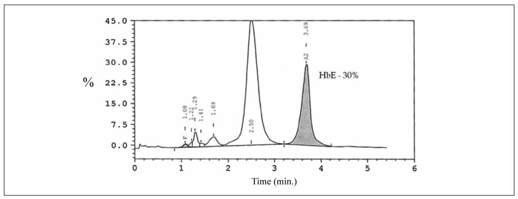 Haemoglobin electrophoresis and HPLC – HAEMA